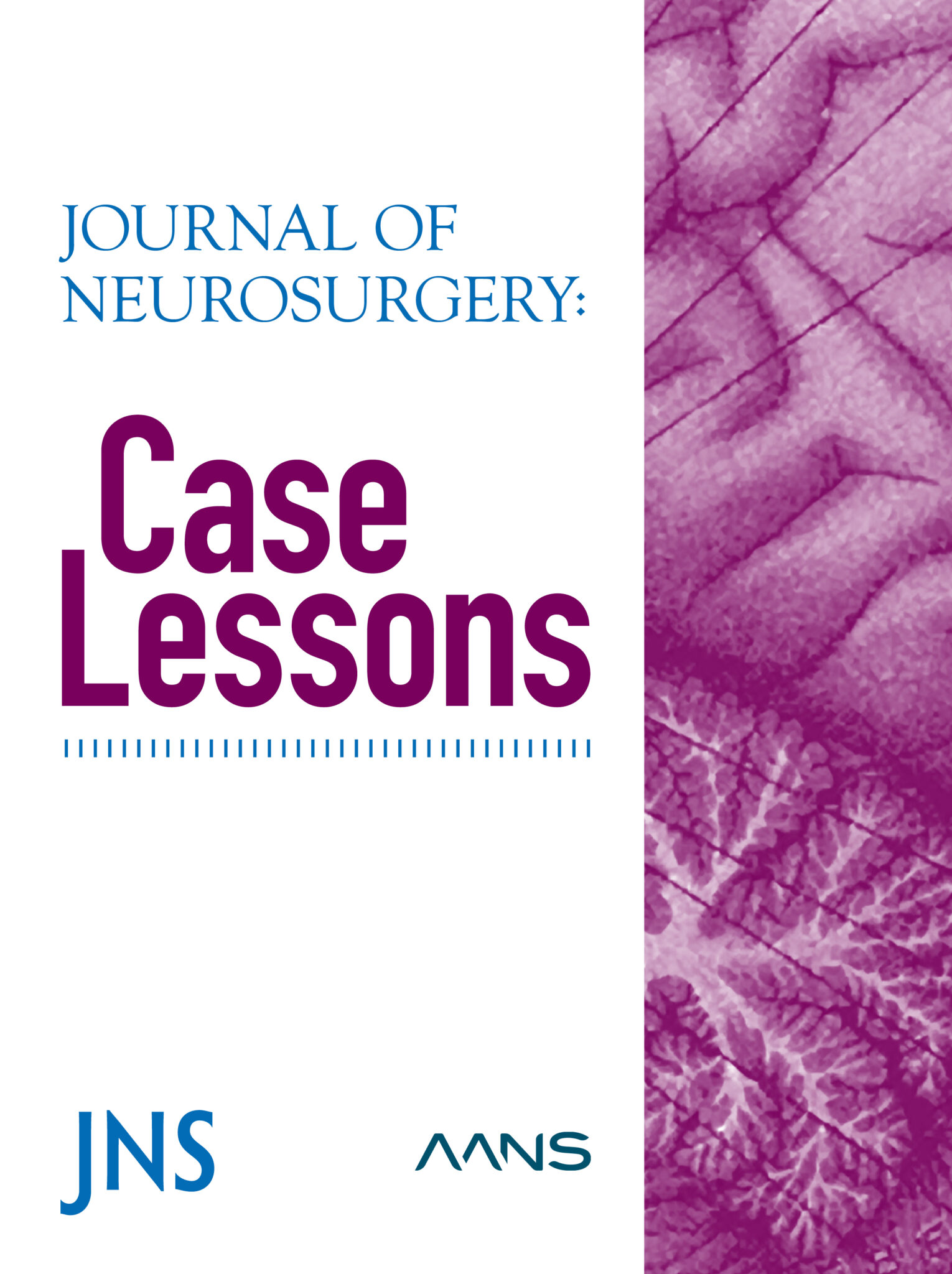 Journal of Neurosurgery Publishing Group - AANS