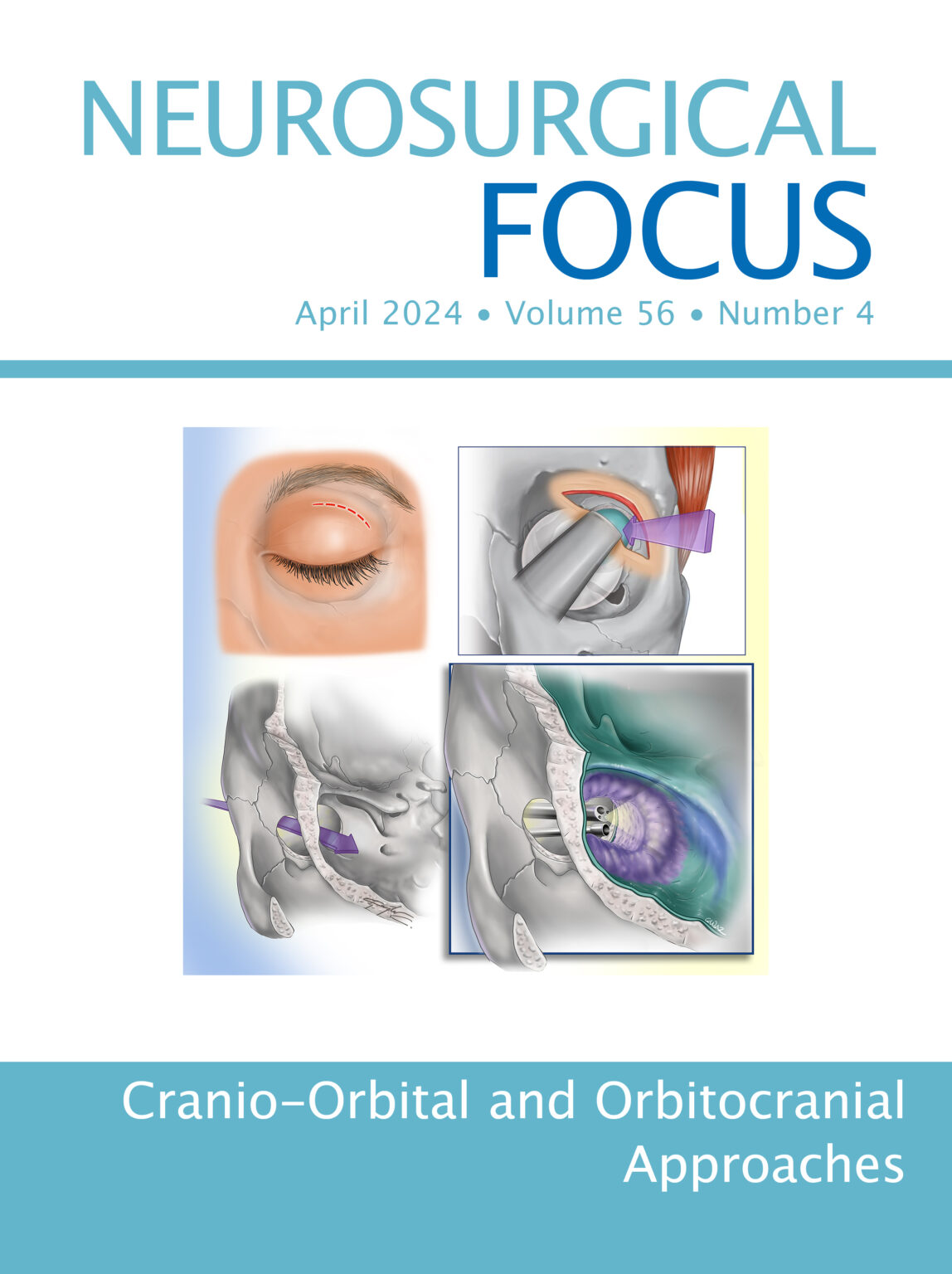 Journal of Neurosurgery Publishing Group - AANS