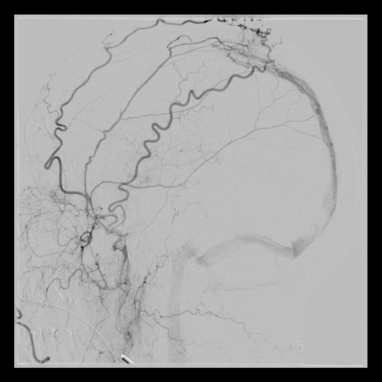 Comprehensive Cerebrovascular Imaging | AANS