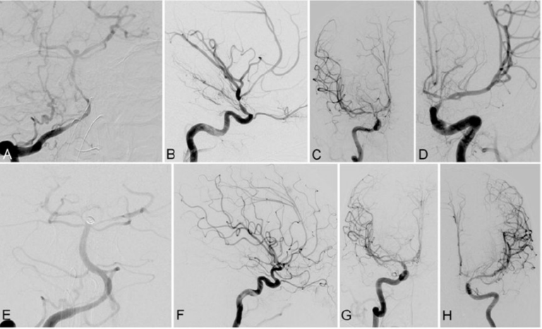 Comprehensive Cerebrovascular Imaging | AANS