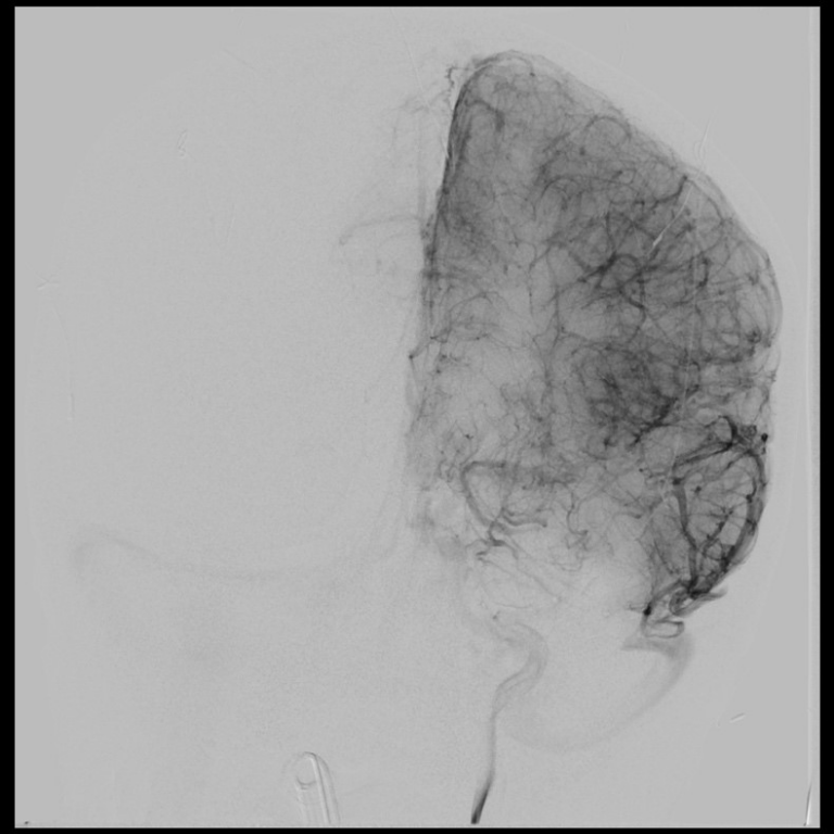 Comprehensive Cerebrovascular Imaging | AANS