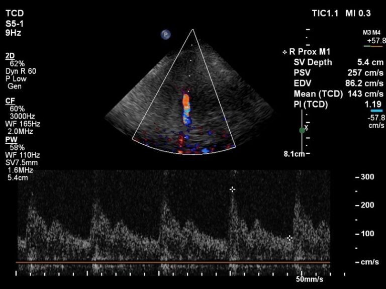 Comprehensive Cerebrovascular Imaging | AANS