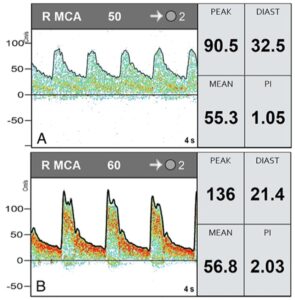 Comprehensive Cerebrovascular Imaging | AANS